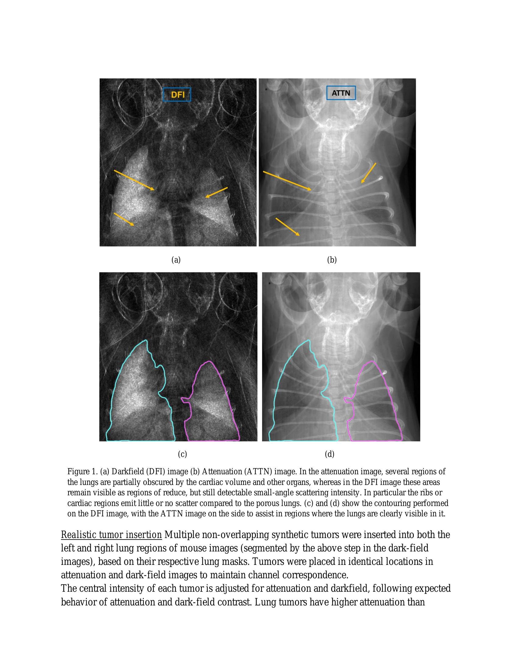 Dark-Field X-Ray Imaging Significantly Improves Deep-Learning based ...