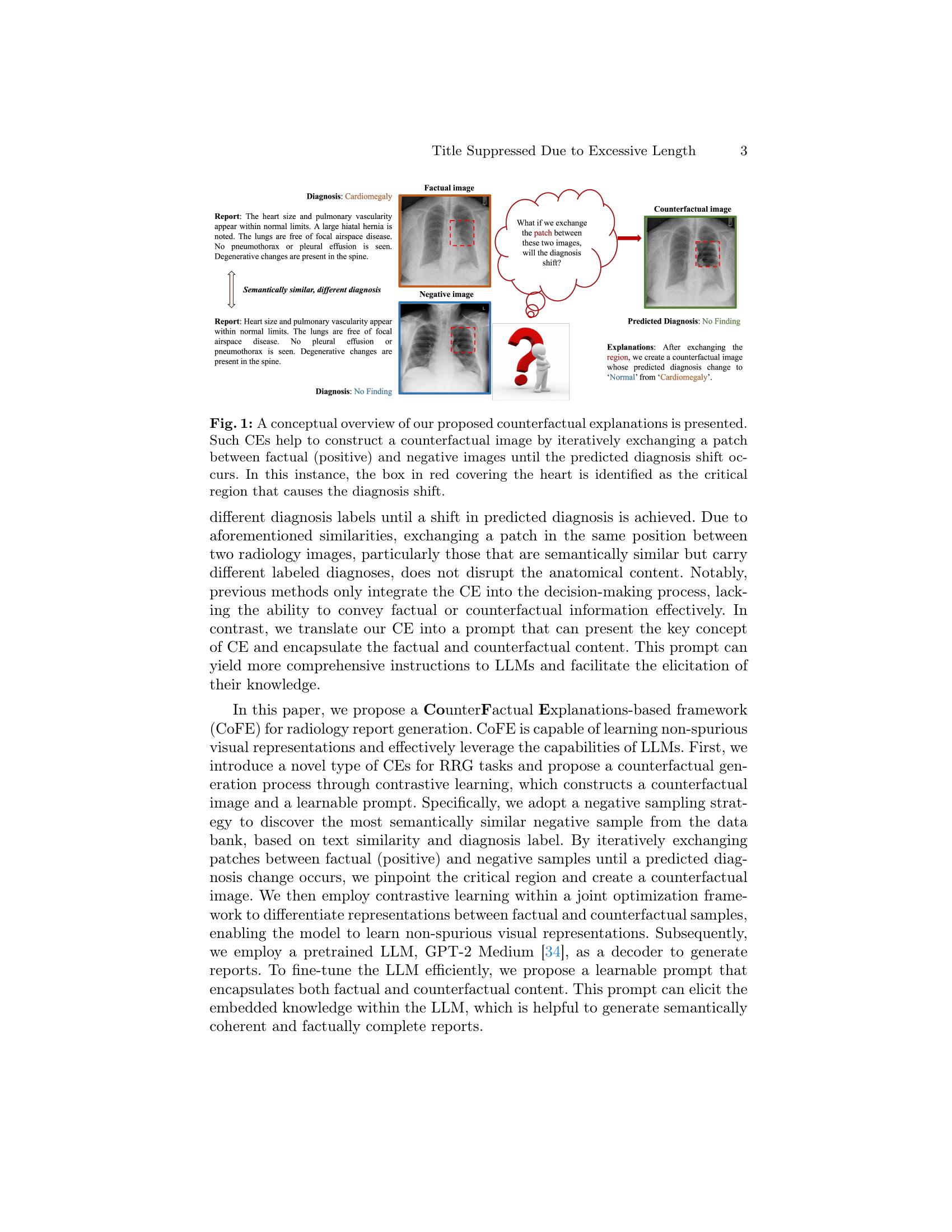 Contrastive Learning with Counterfactual Explanations for Radiology ...