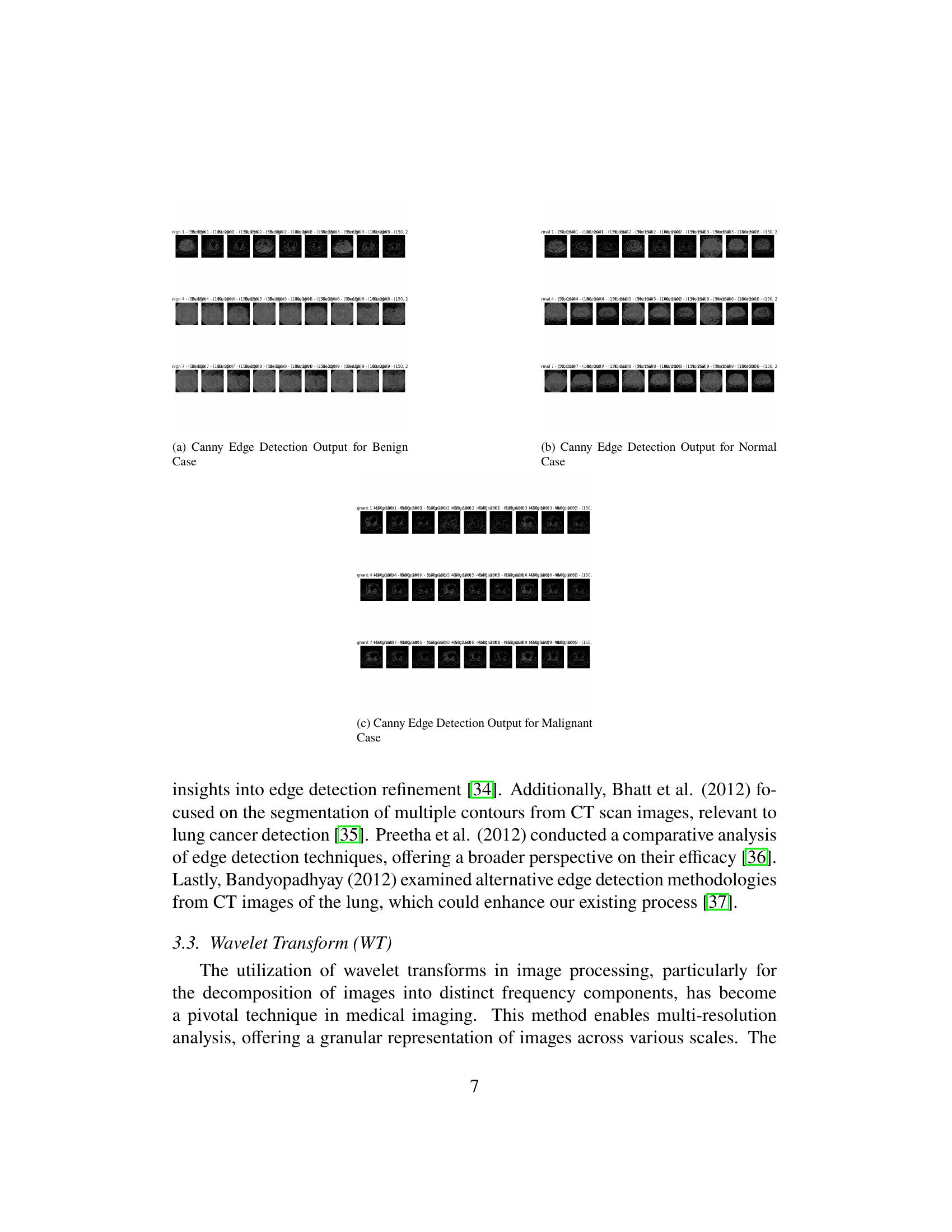 Optimizing Lung Cancer Detection in CT Imaging: A Wavelet Multi-Layer ...
