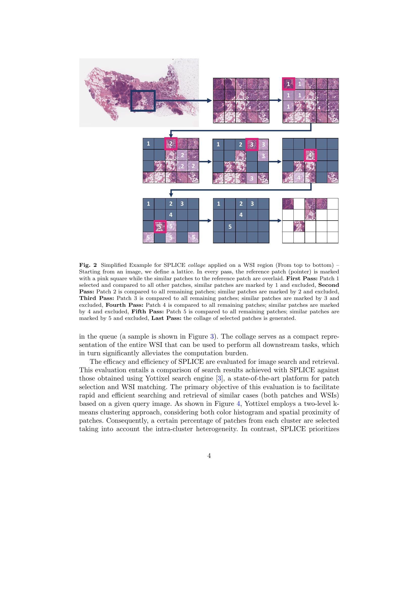 SPLICE -- Streamlining Digital Pathology Image Processing - 智源社区论文