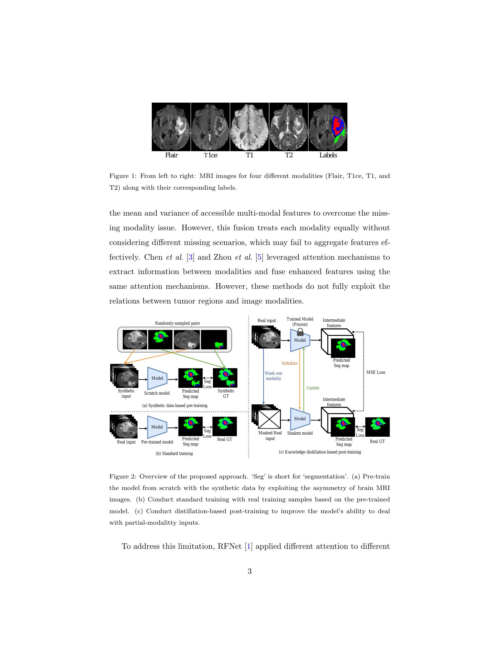 Enhancing Incomplete Multi-modal Brain Tumor Segmentation with Intra-modal Asymmetry and Inter ...