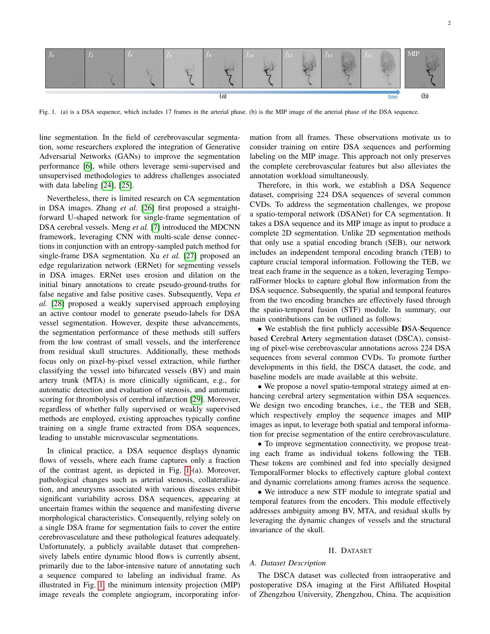 DSCA: A Digital Subtraction Angiography Sequence Dataset and Spatio ...