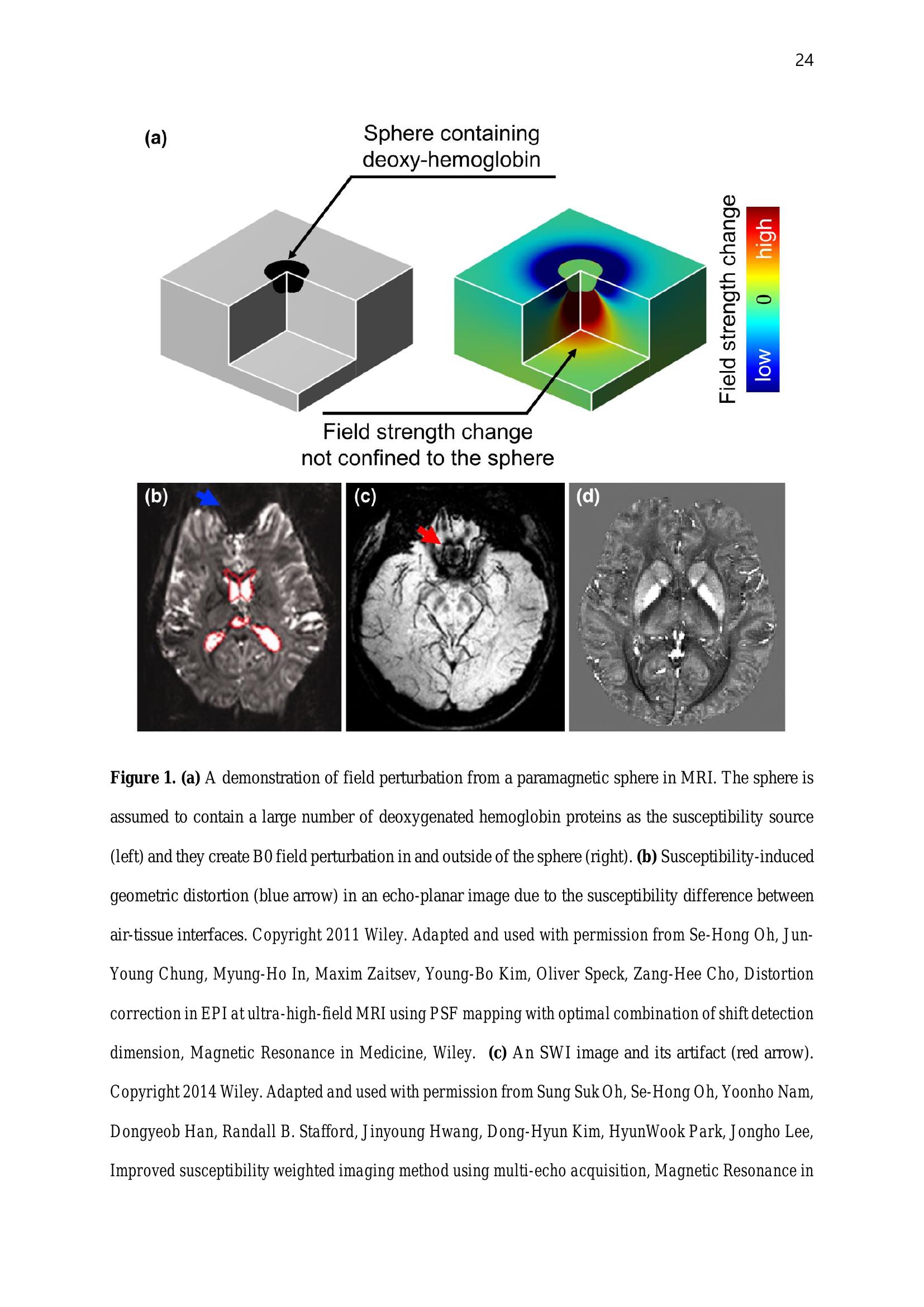 So You Want to Image Myelin Using MRI: Advanced Magnetic Susceptibility ...