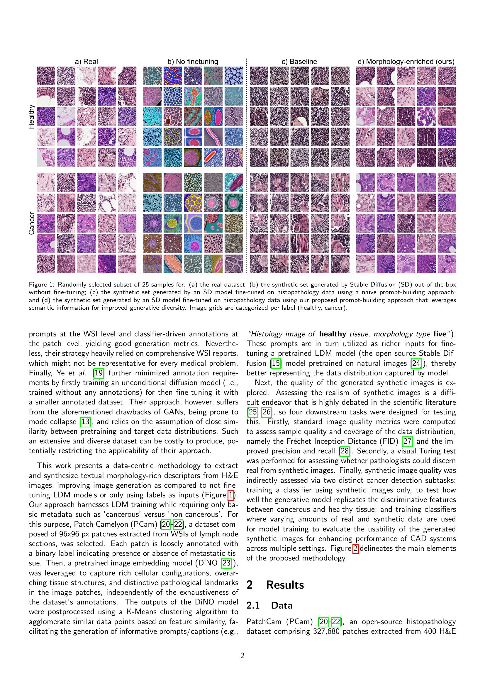 Latent Diffusion Models with Image-Derived Annotations for Enhanced AI ...