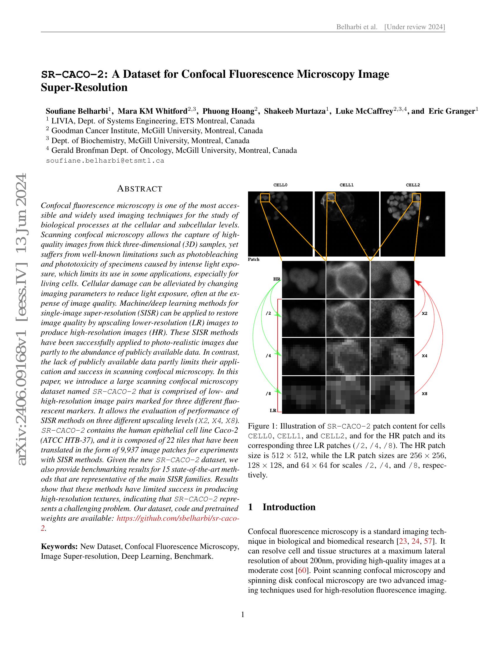 SR-CACO-2: A Dataset for Confocal Fluorescence Microscopy Image Super ...