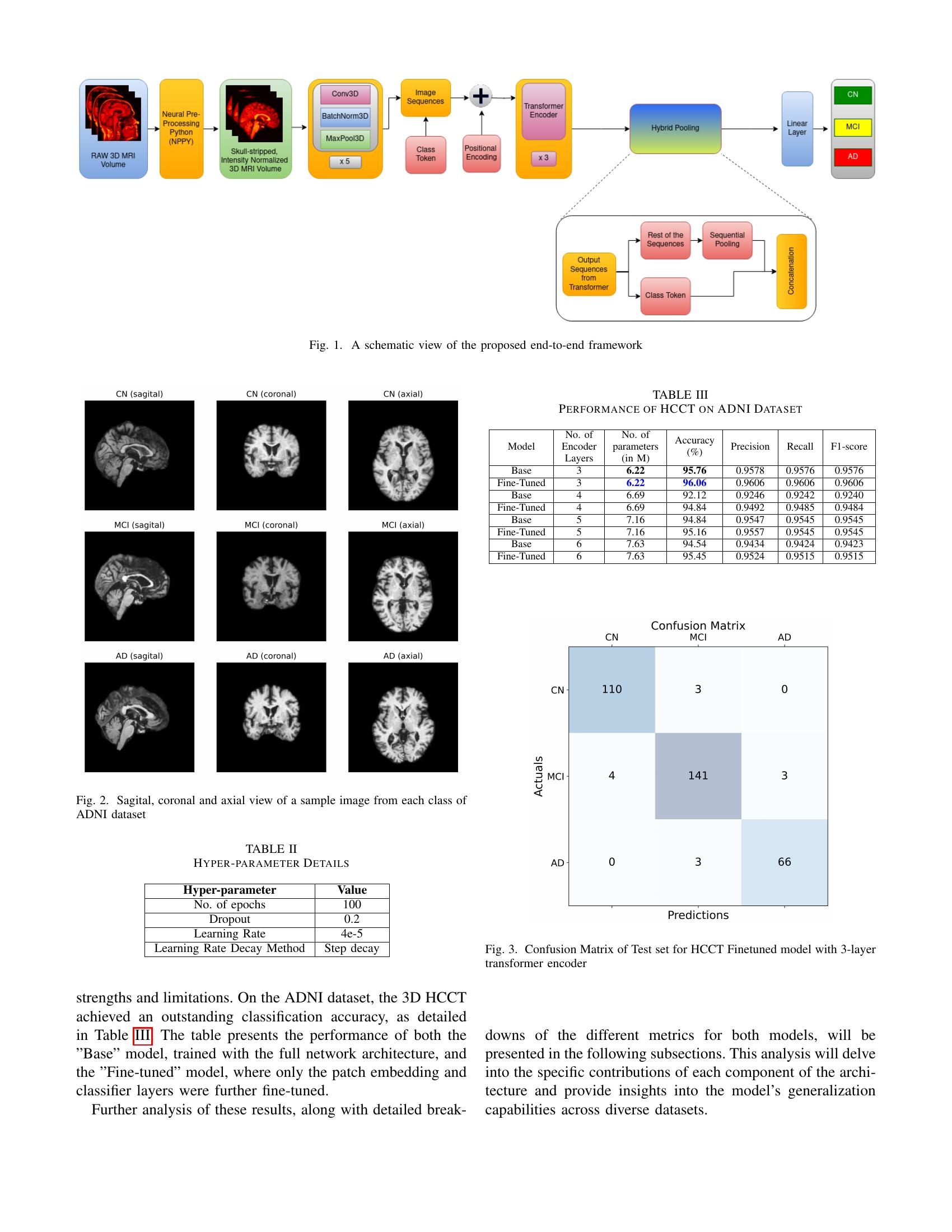 Enhancing MRI-Based Classification of Alzheimer's Disease with ...