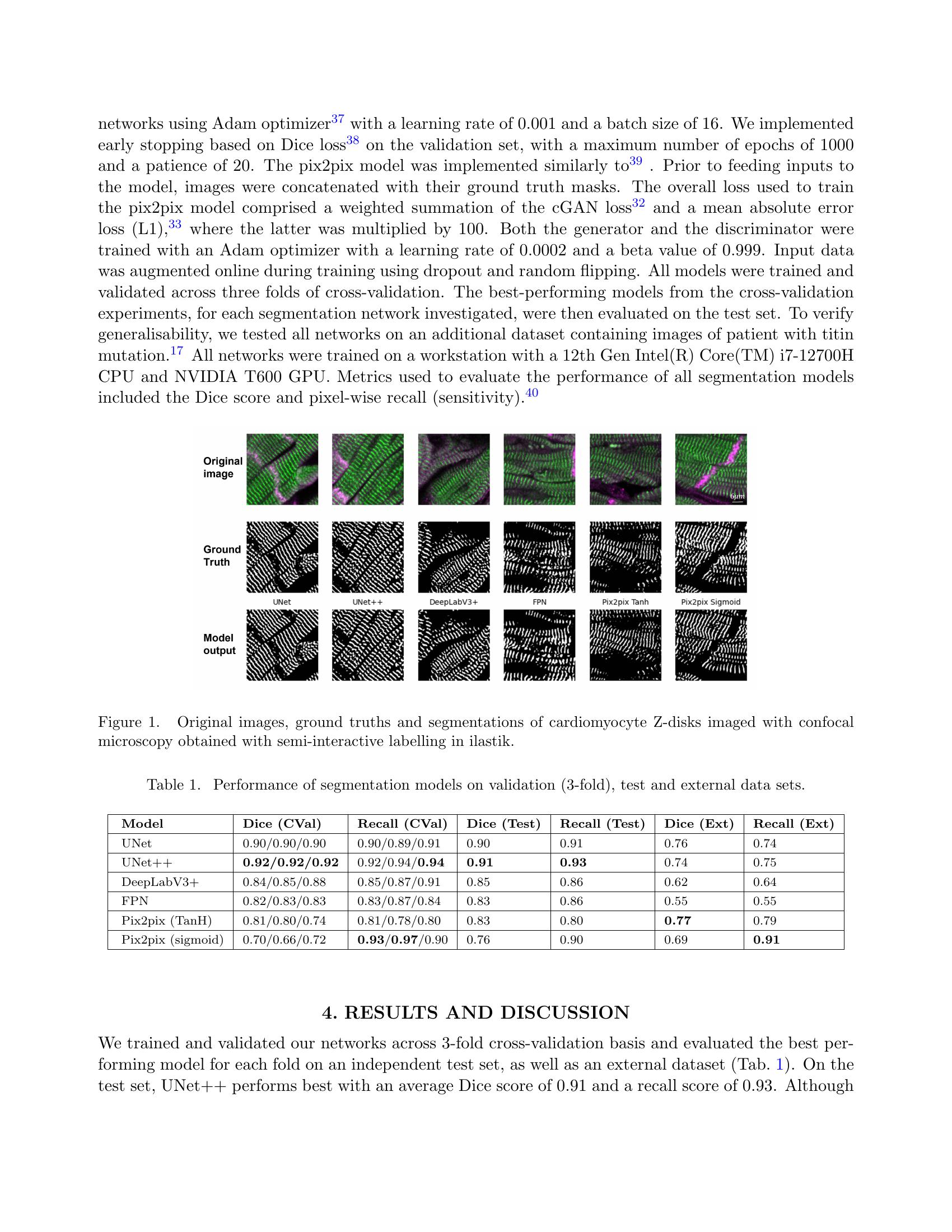 Segmenting Cardiac Muscle Z-disks with Deep Neural Networks - 智源社区论文