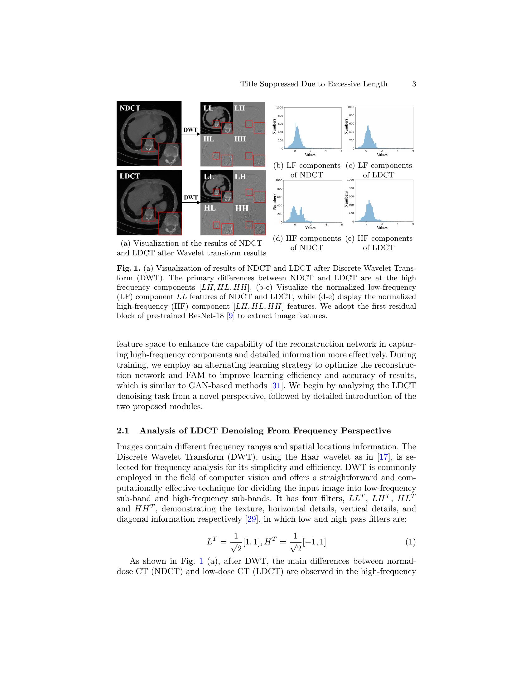 WIA-LD2ND: Wavelet-based Image Alignment for Self-supervised Low-Dose ...