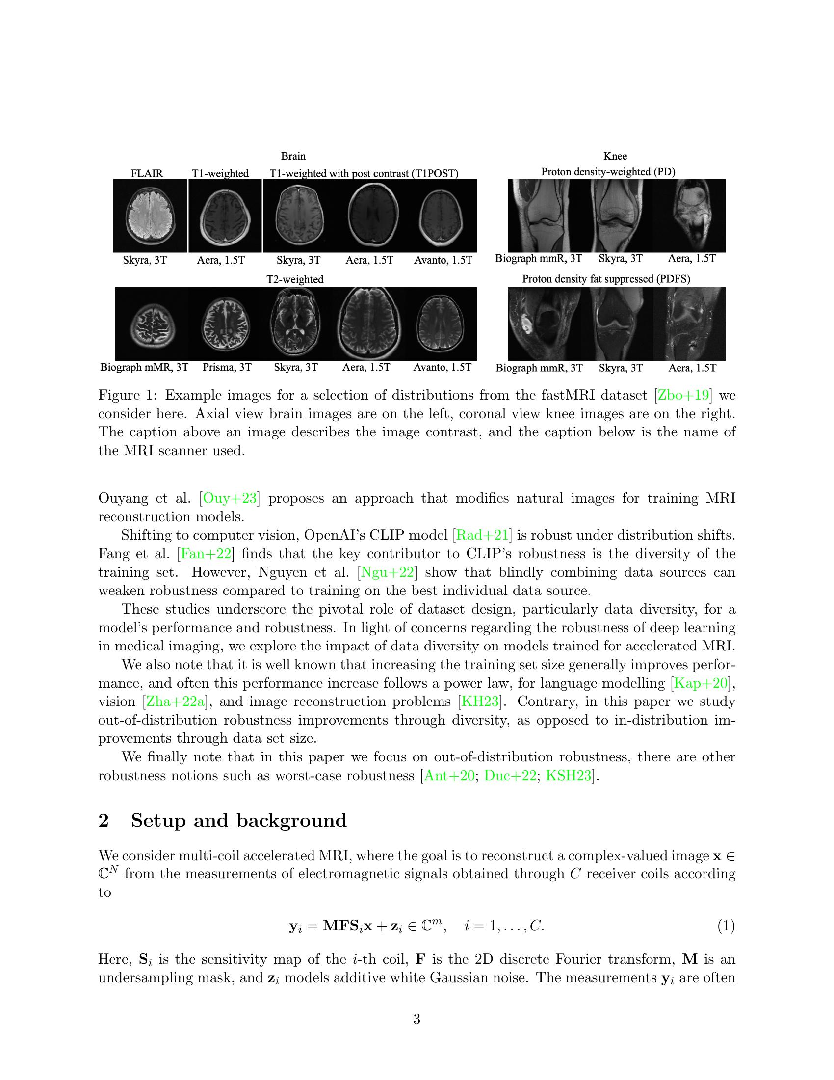 Robustness of Deep Learning for Accelerated MRI: Benefits of Diverse ...