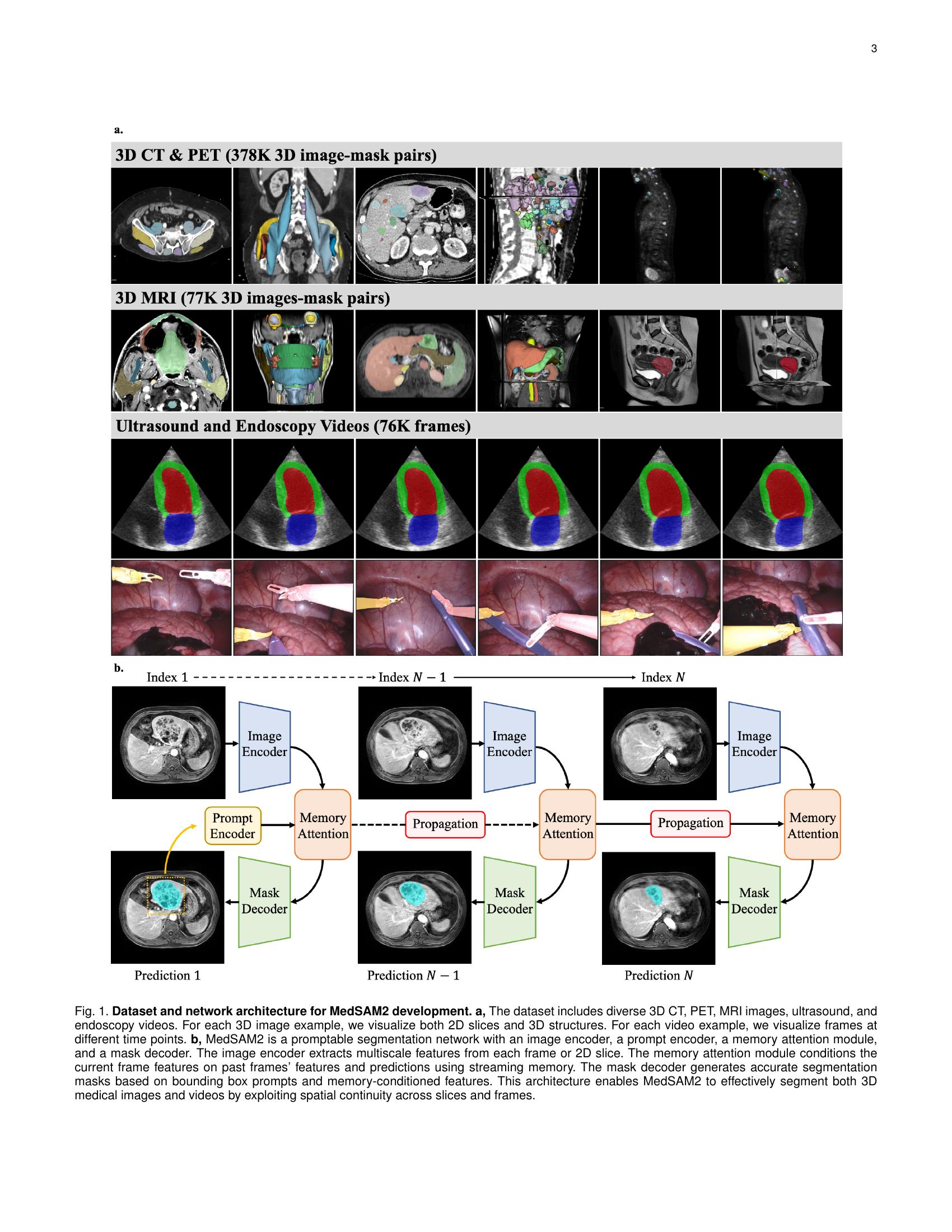 MedSAM2: Segment Anything in 3D Medical Images and Videos - 智源社区论文