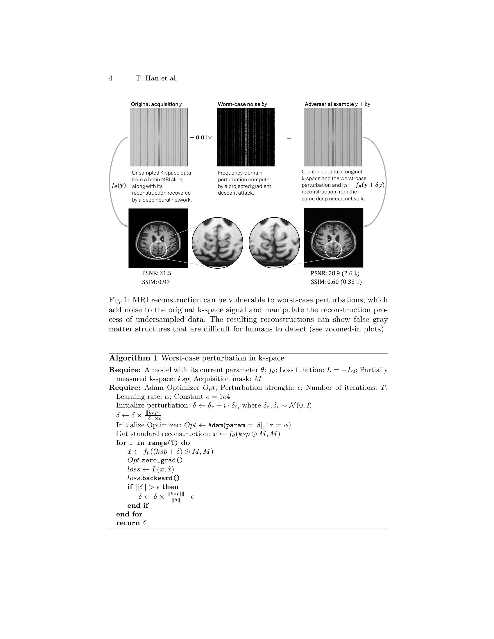 On Instabilities of Unsupervised Denoising Diffusion Models in Magnetic ...
