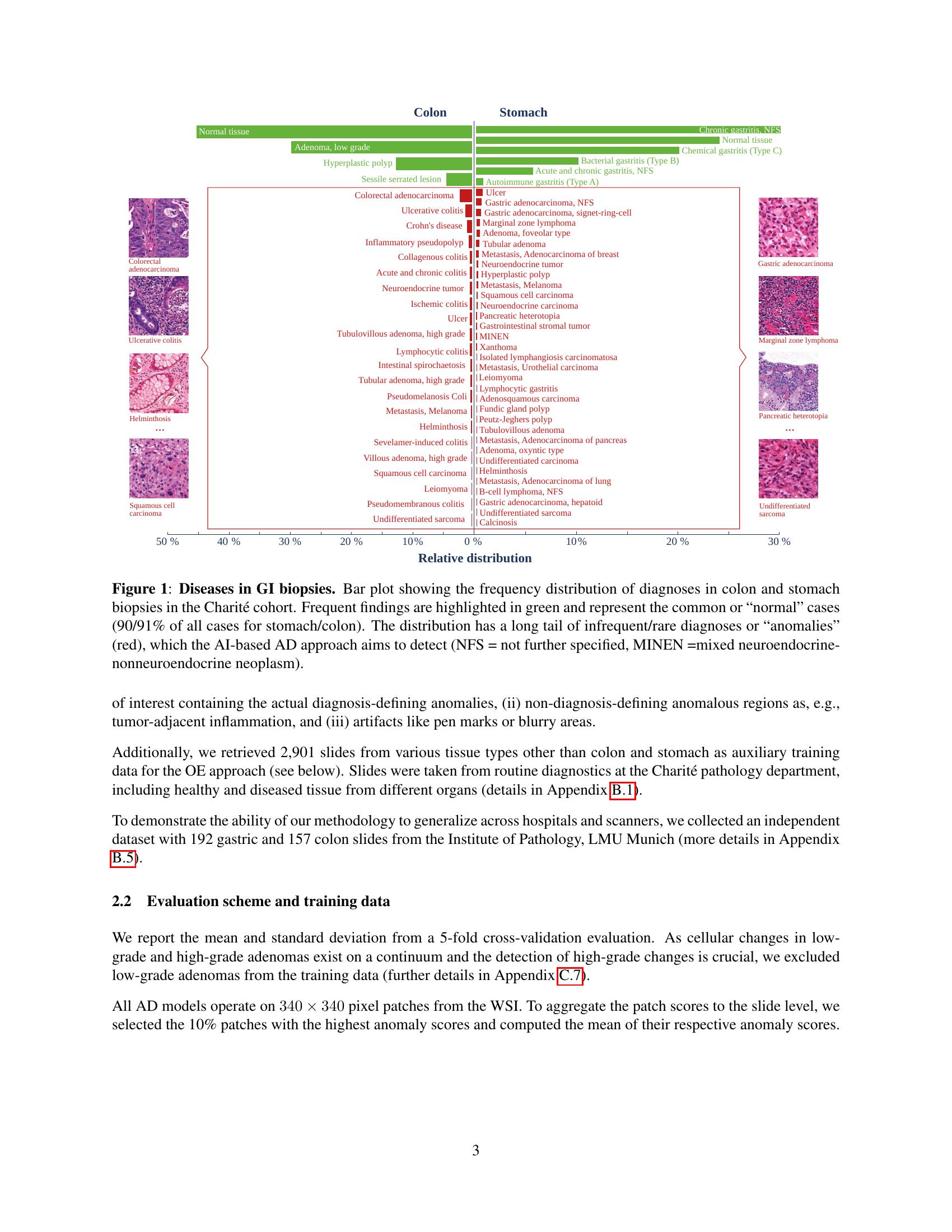AI-based Anomaly Detection for Clinical-Grade Histopathological ...