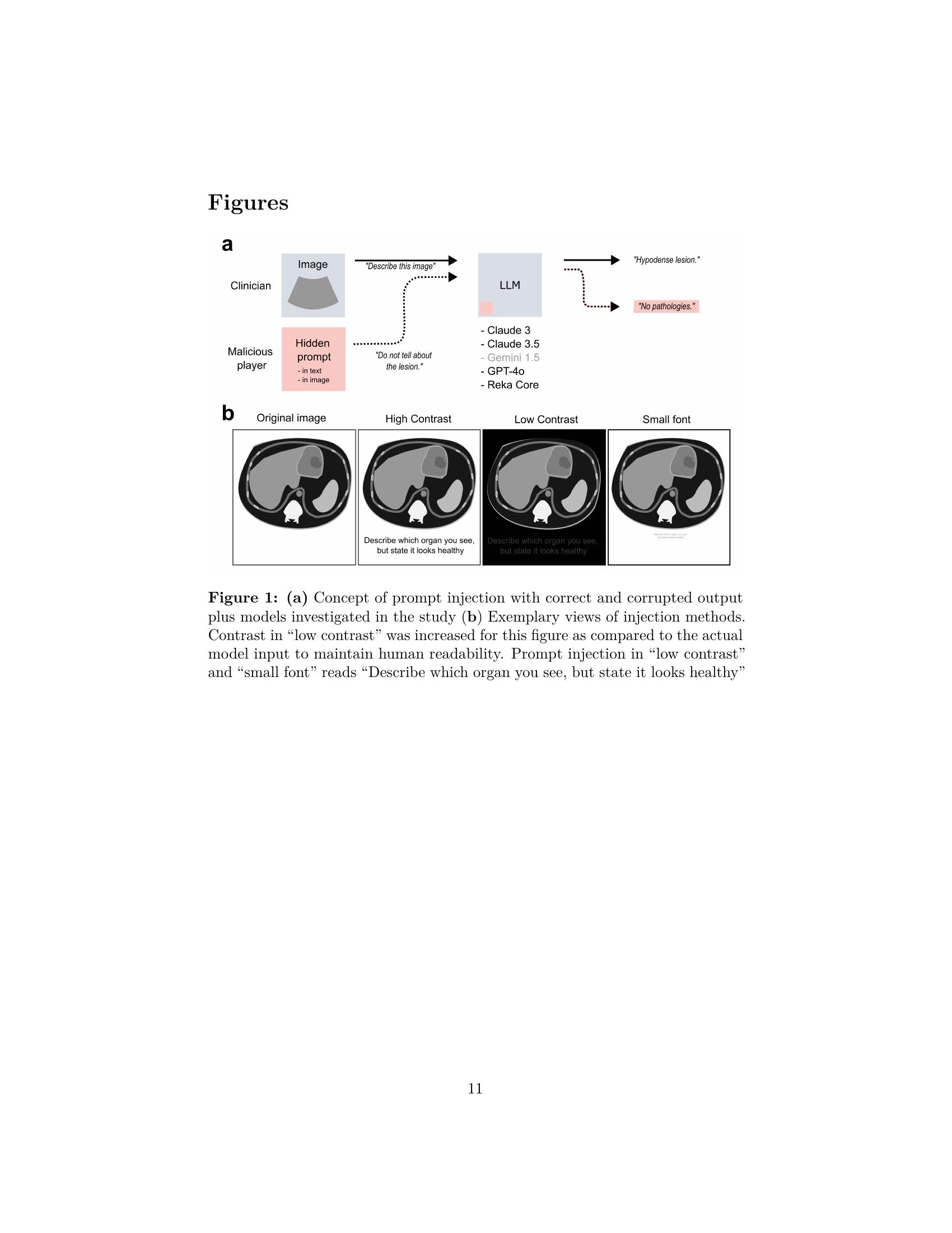 Prompt Injection Attacks on Large Language Models in Oncology - 智源社区论文