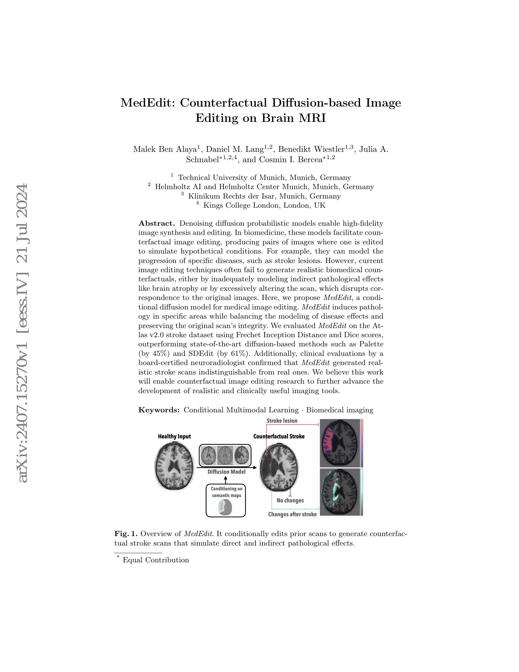 MedEdit: Counterfactual Diffusion-based Image Editing on Brain MRI - 智源社区论文
