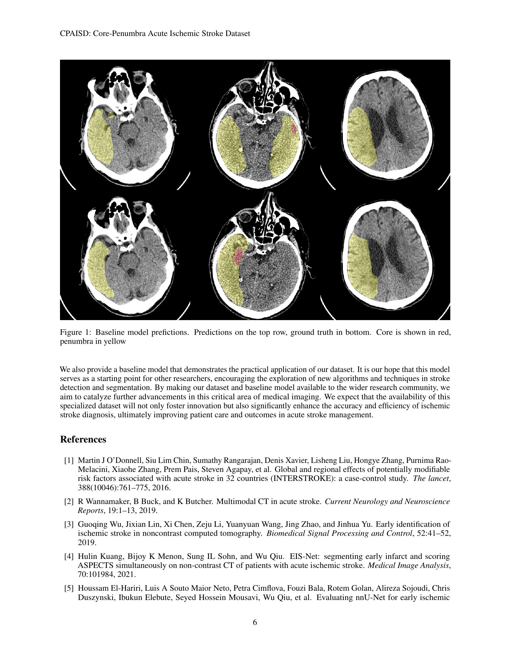 CPAISD: Core-penumbra acute ischemic stroke dataset - 智源社区论文