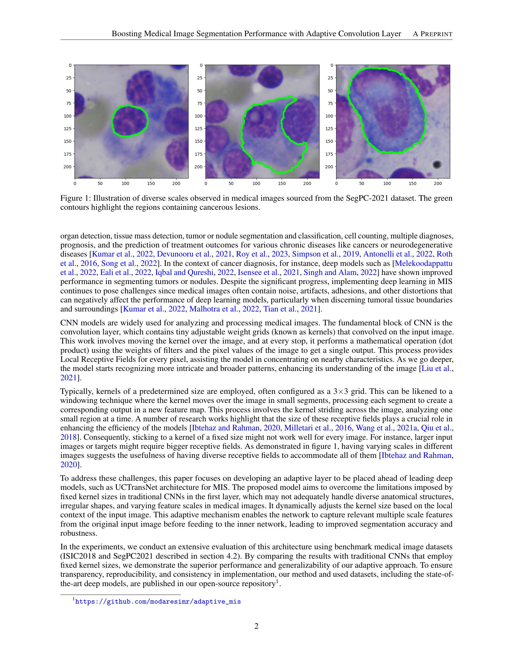 Boosting Medical Image Segmentation Performance with Adaptive Convolution Layer - 智源社区论文