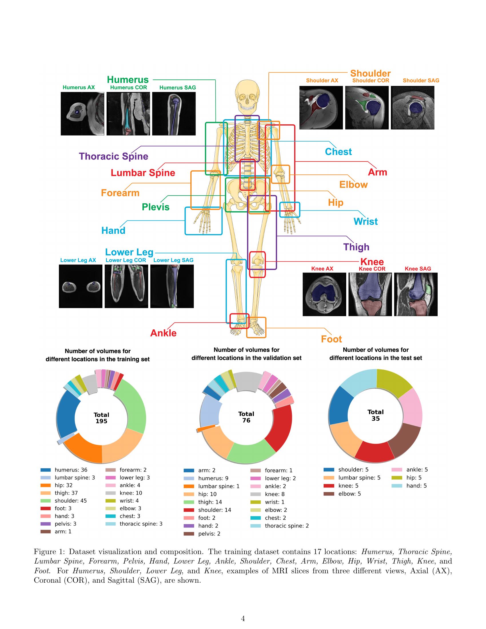 SegmentAnyBone: A Universal Model that Segments Any Bone at Any ...