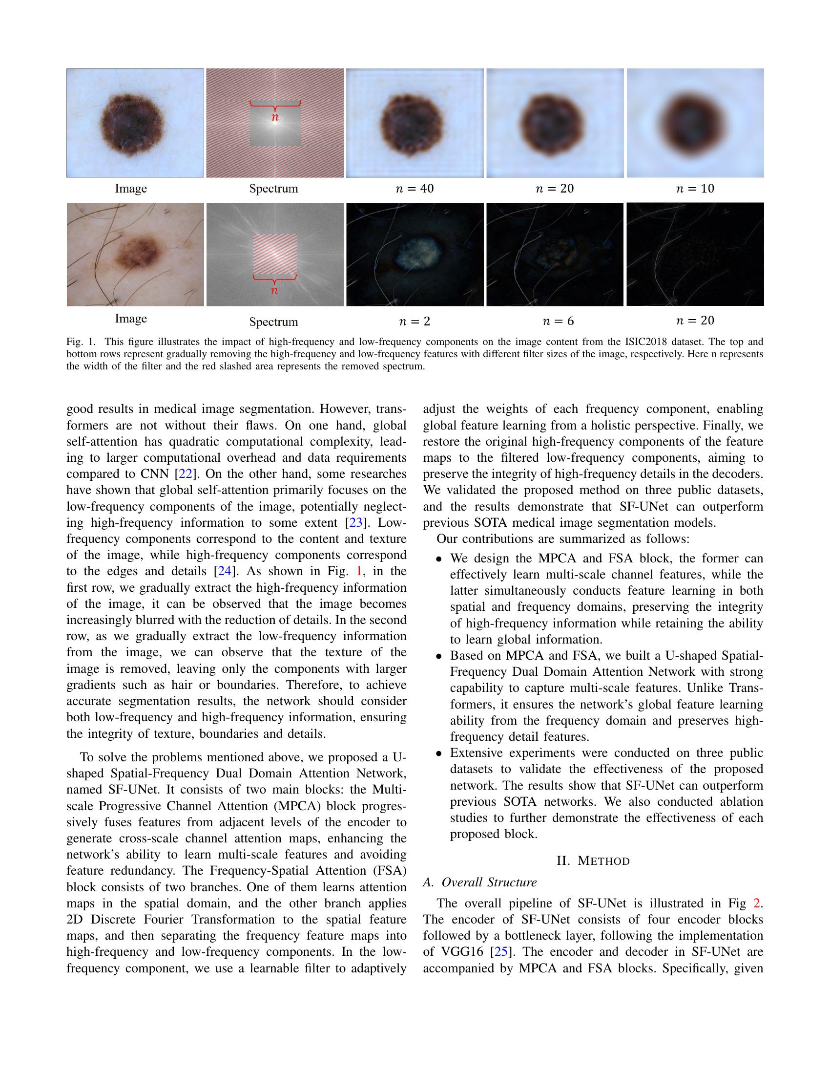 Spatial-Frequency Dual Progressive Attention Network For Medical Image ...
